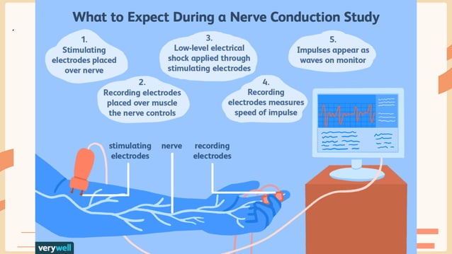 peripheral neuropathy-Diagnostic approach.pptx