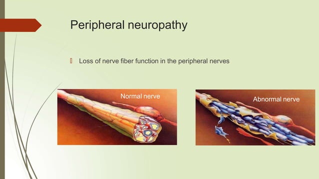 peripheral neuropathy.pptx