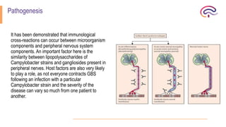 peripheral neuropathy (introduction and Gillian barre syndrome .pptx