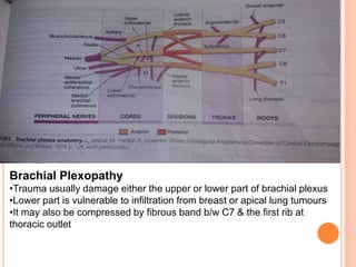 Peripheral neuropathy | PPTX