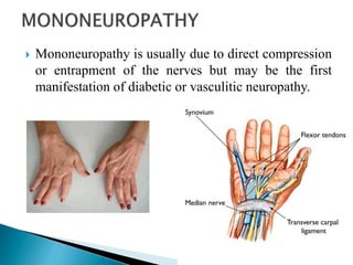 Peripheral neuropathy in older people | PPT