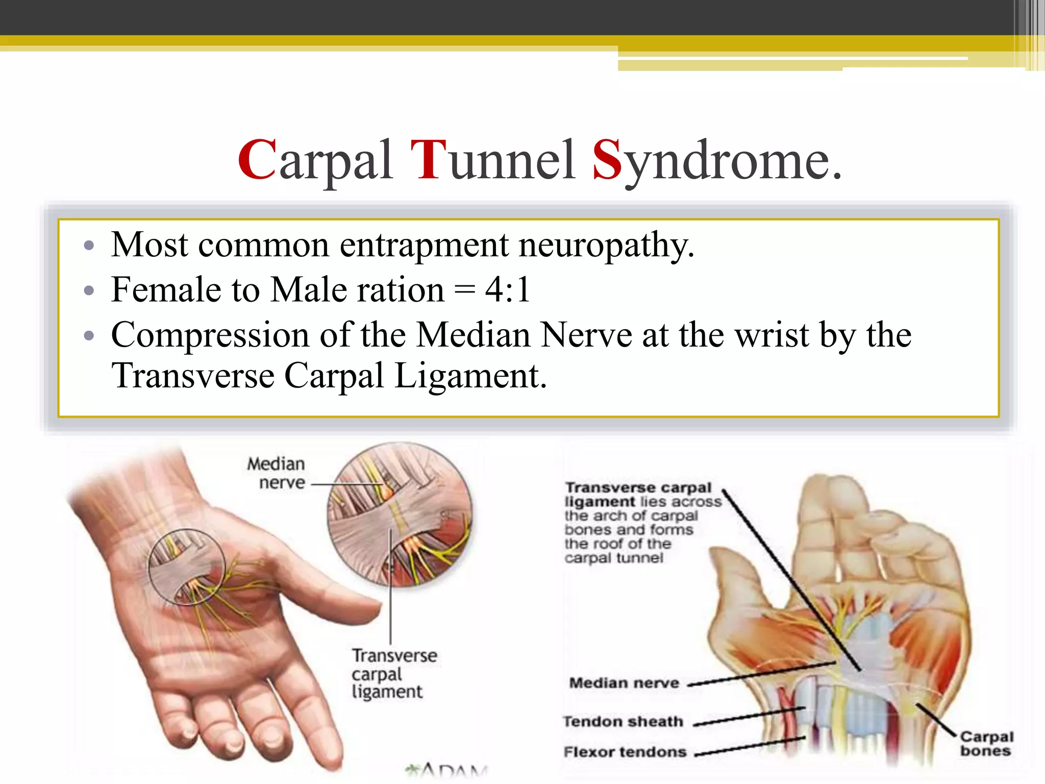 Peripheral neuropathy objective 3 (cts) | PPTX