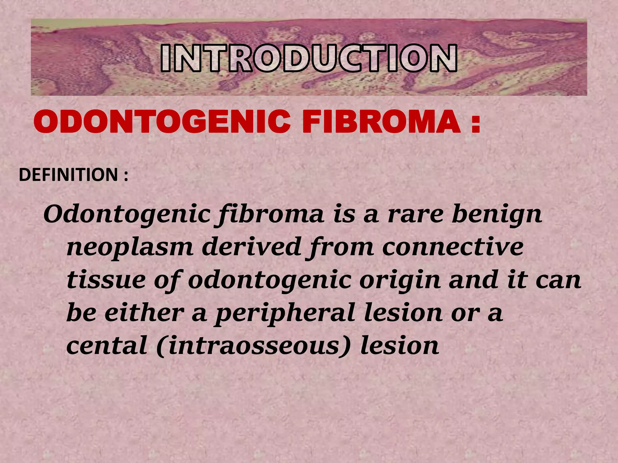 Peripheral odontogenic fibroma | PPTX