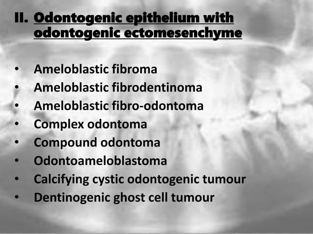 Peripheral odontogenic fibroma | PPTX