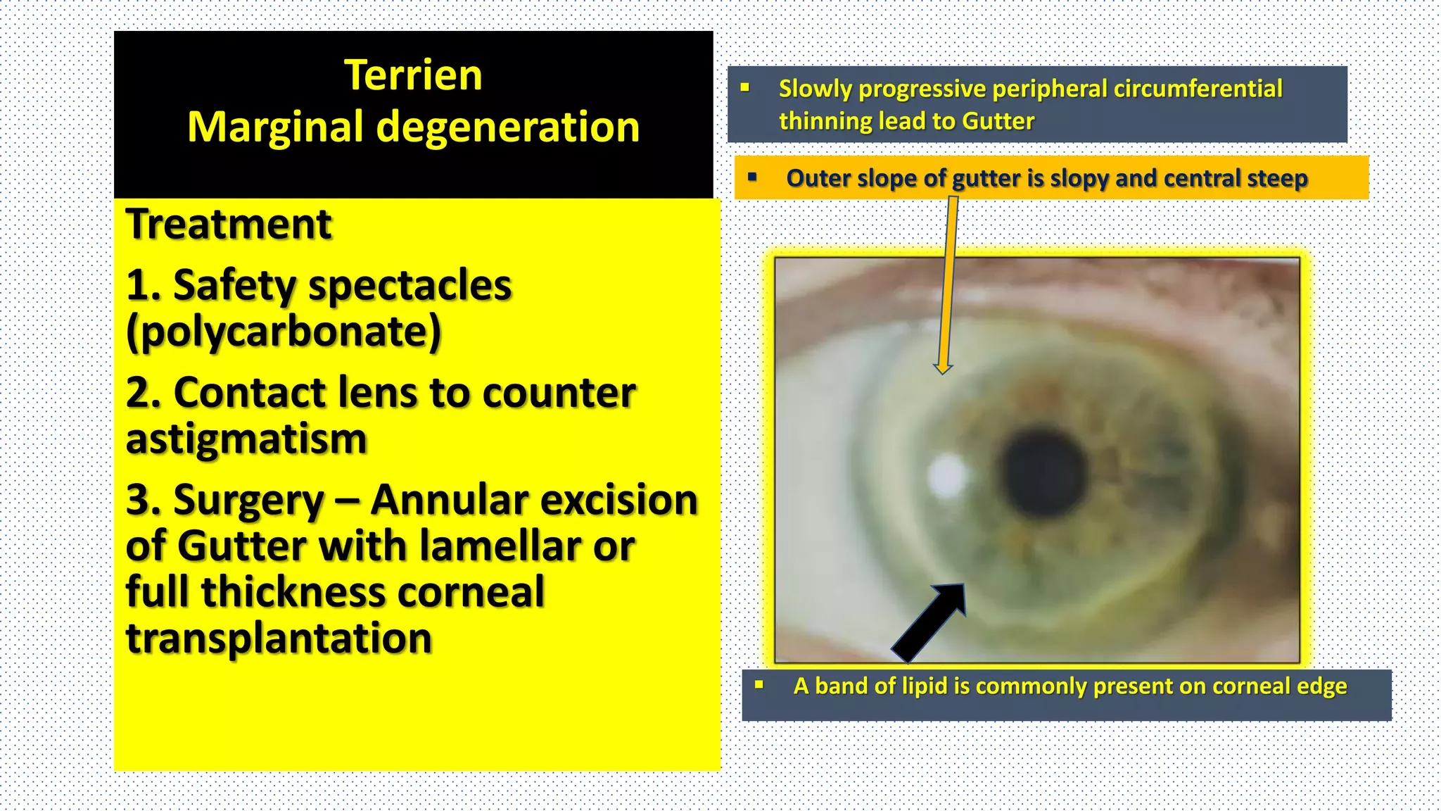 Peripheral or Marginal keratitis_025603.pptx