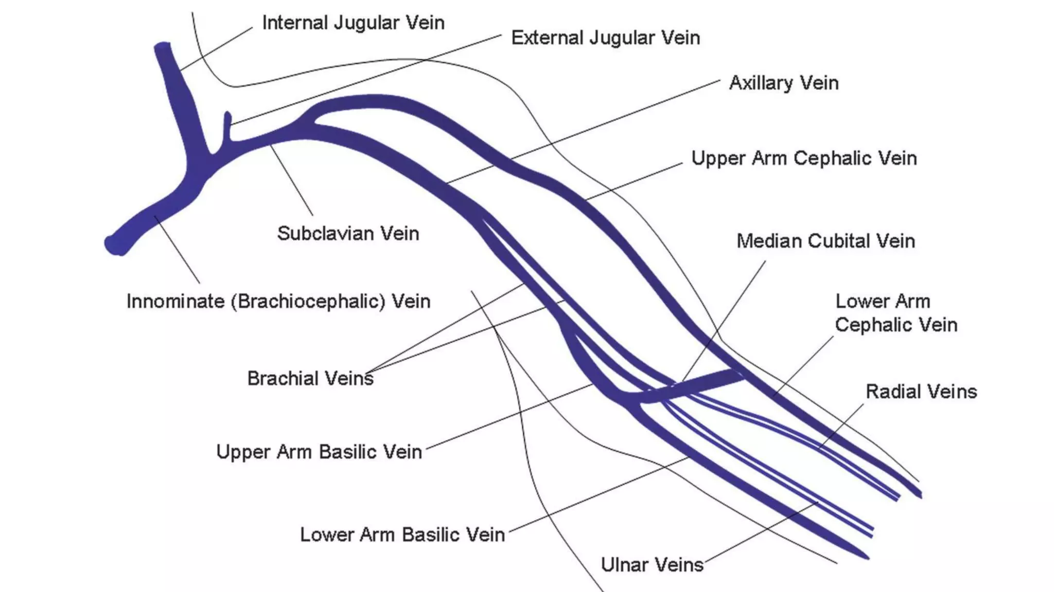 Peripheral portacath - Article - TR - 2019 | PPTX