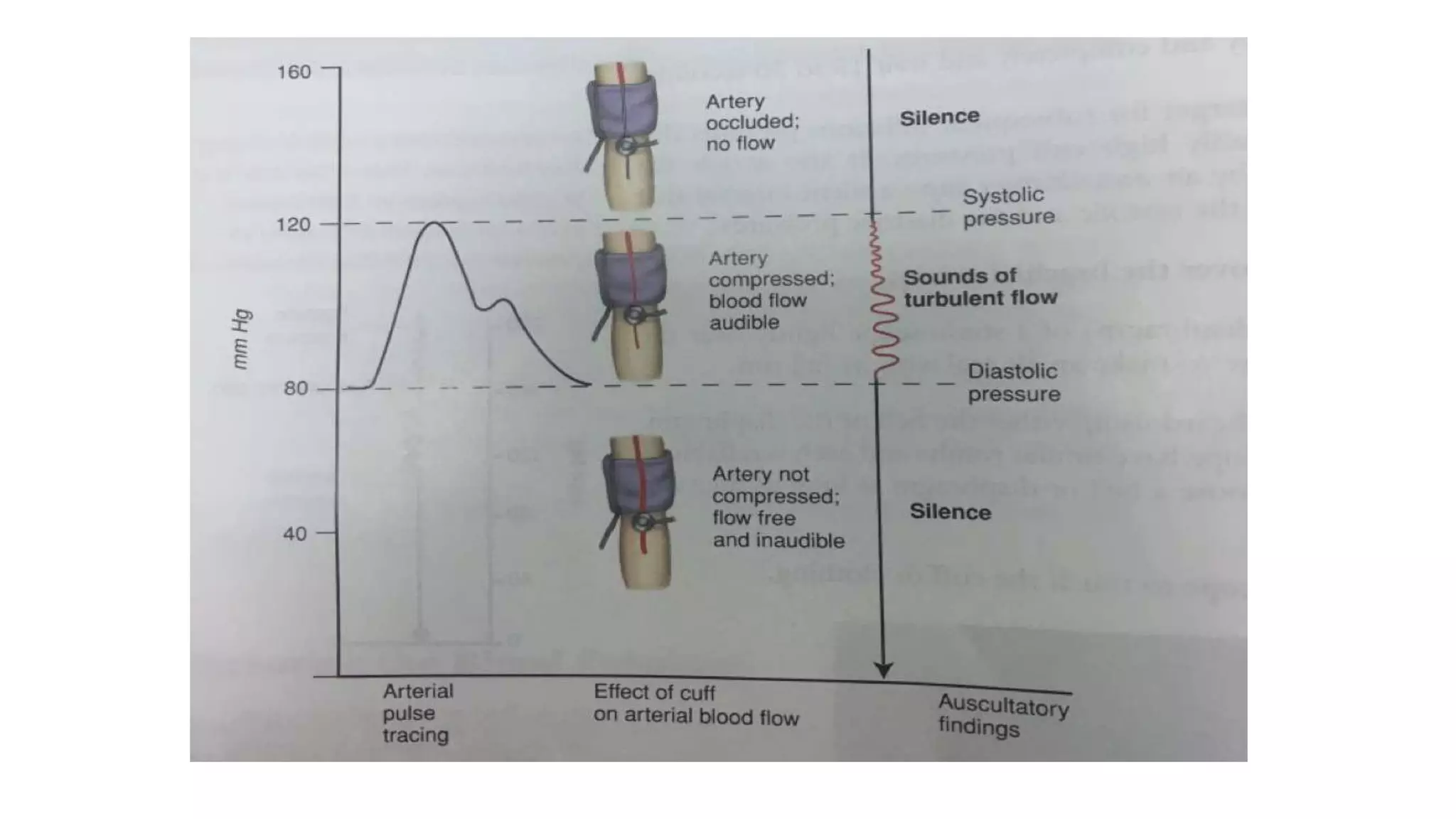 Peripheral pulsations and blood pressure measurement | PPTX