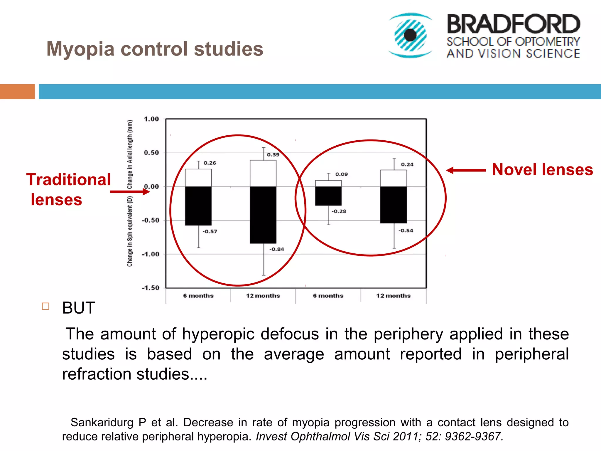 Peripheral refraction in myopia | PPT