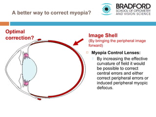 Peripheral refraction in myopia | PPT