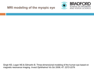 Peripheral refraction in myopia | PPT