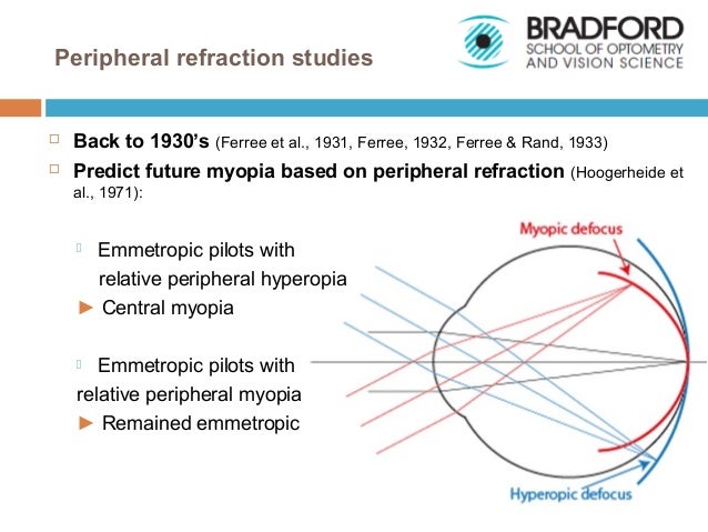 Peripheral refraction in myopia