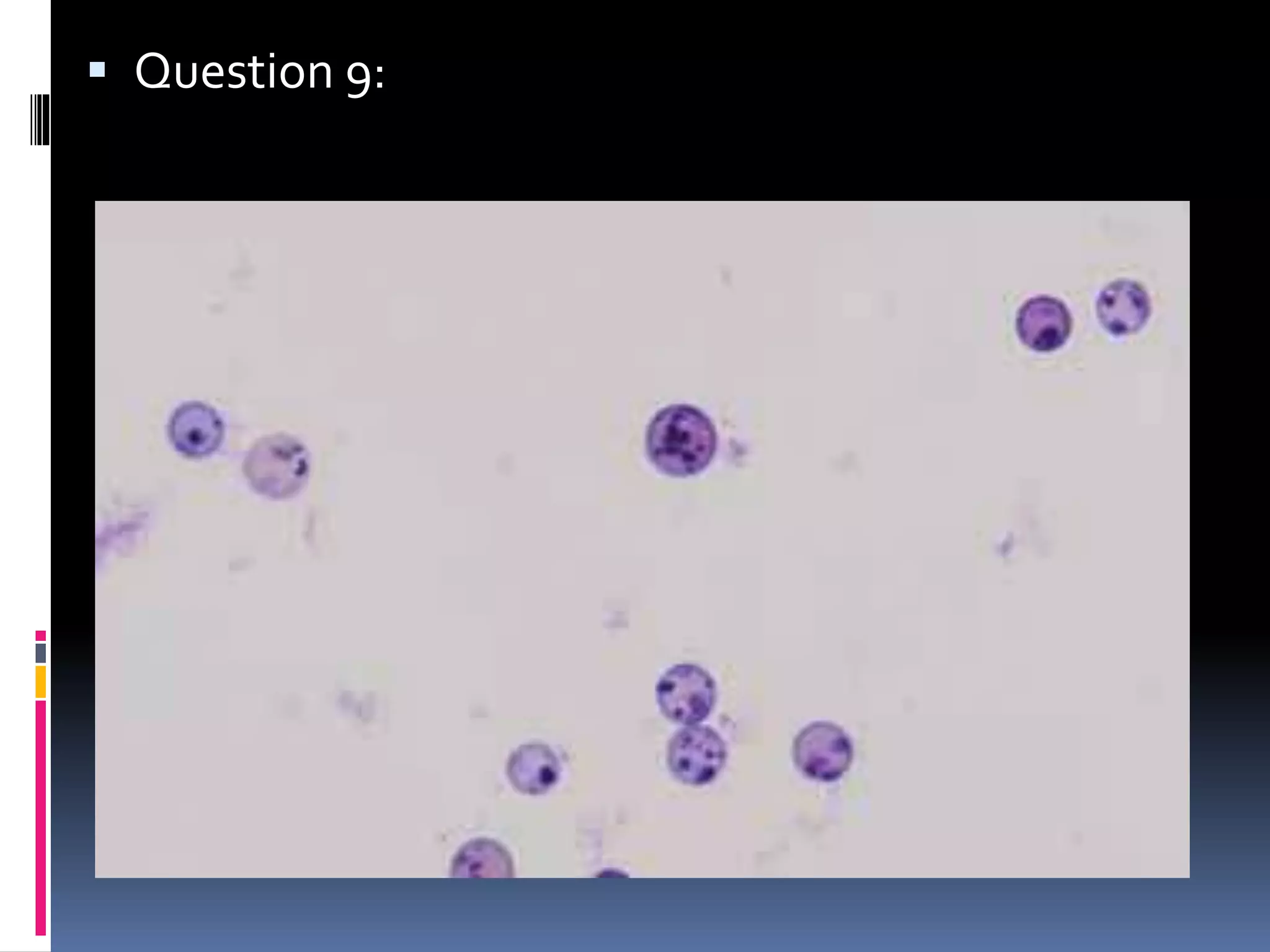 Peripheral smear..RBC disorders.. Dr.Padmesh | PPTX