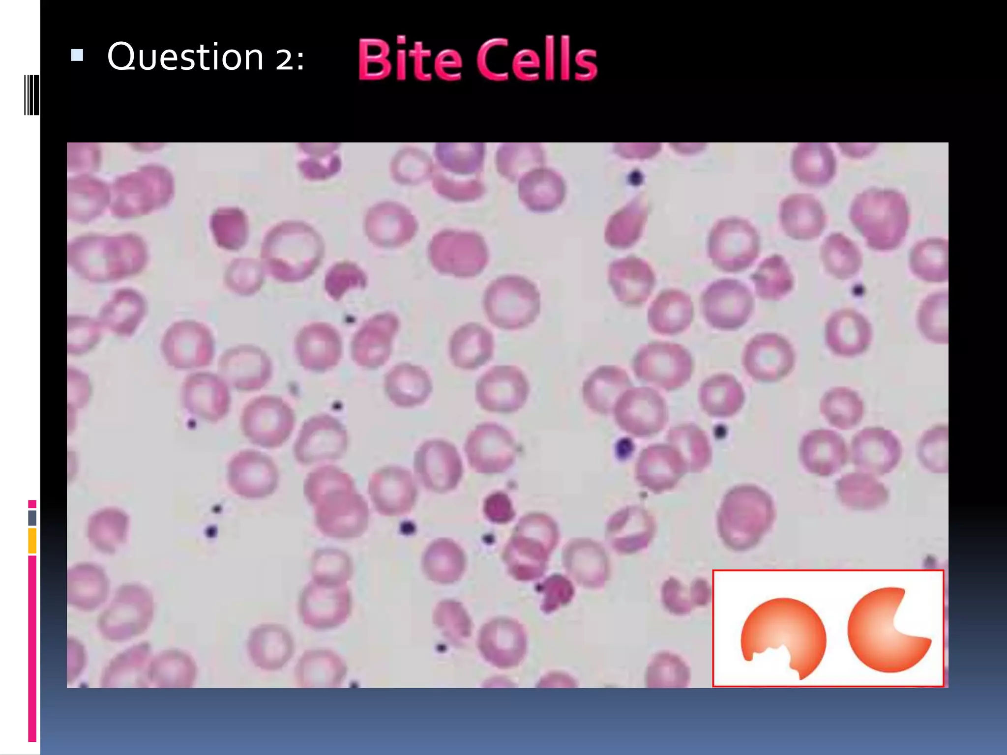 Peripheral smear..RBC disorders.. Dr.Padmesh | PPTX