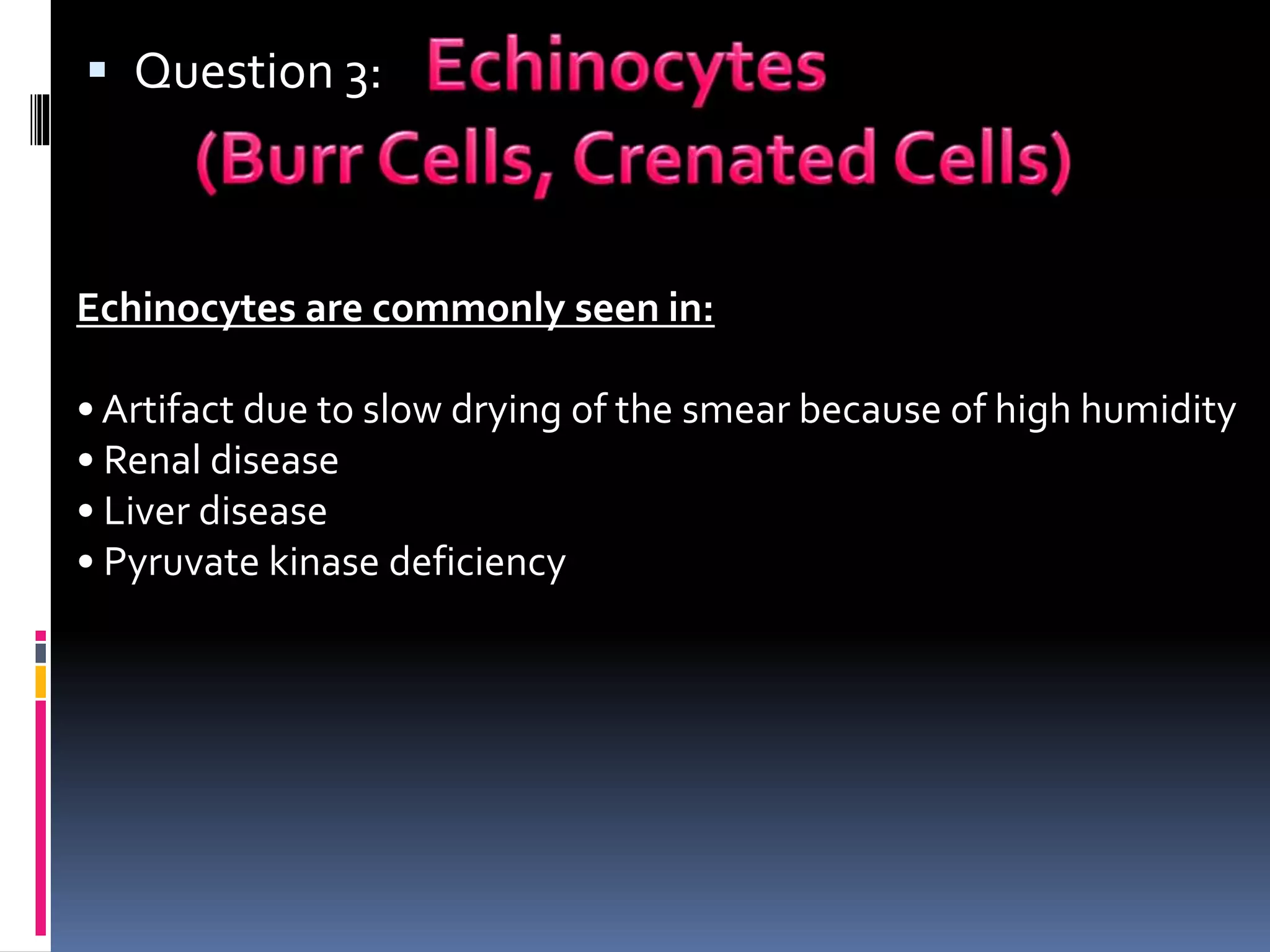 Peripheral smear..RBC disorders.. Dr.Padmesh | PPTX
