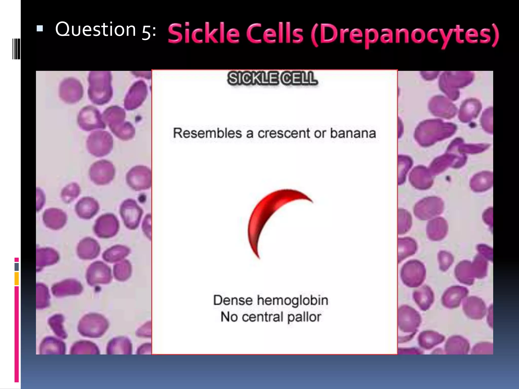 Peripheral smear..RBC disorders.. Dr.Padmesh | PPTX