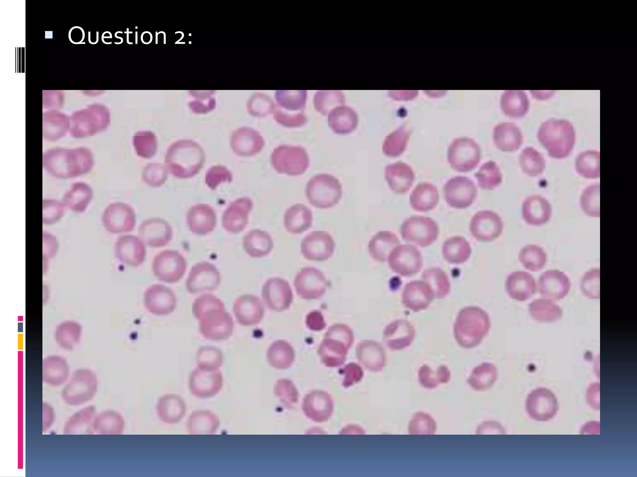 Peripheral smear..RBC disorders.. Dr.Padmesh | PPT | Free Download