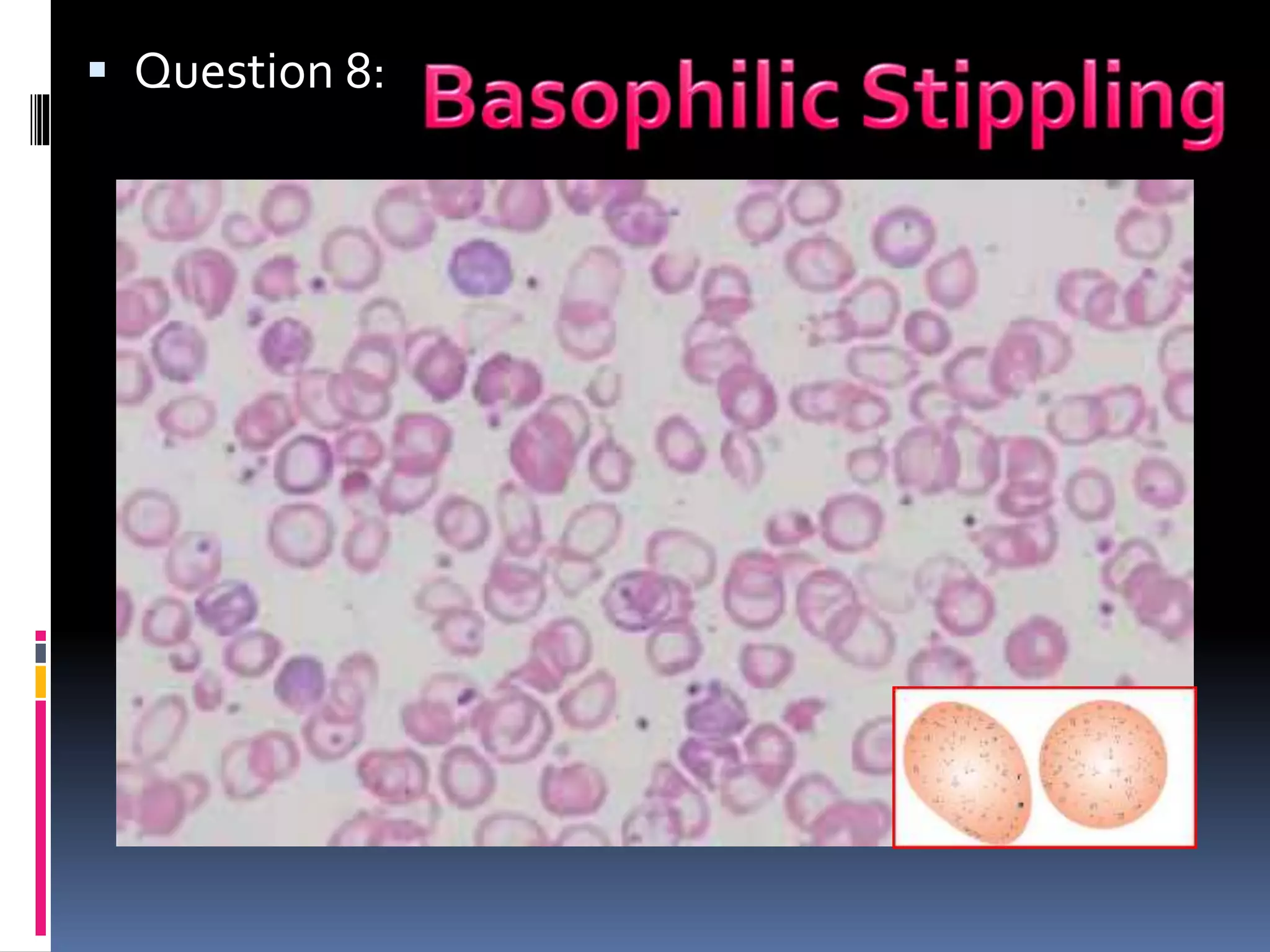 Peripheral smear..RBC disorders.. Dr.Padmesh | PPTX