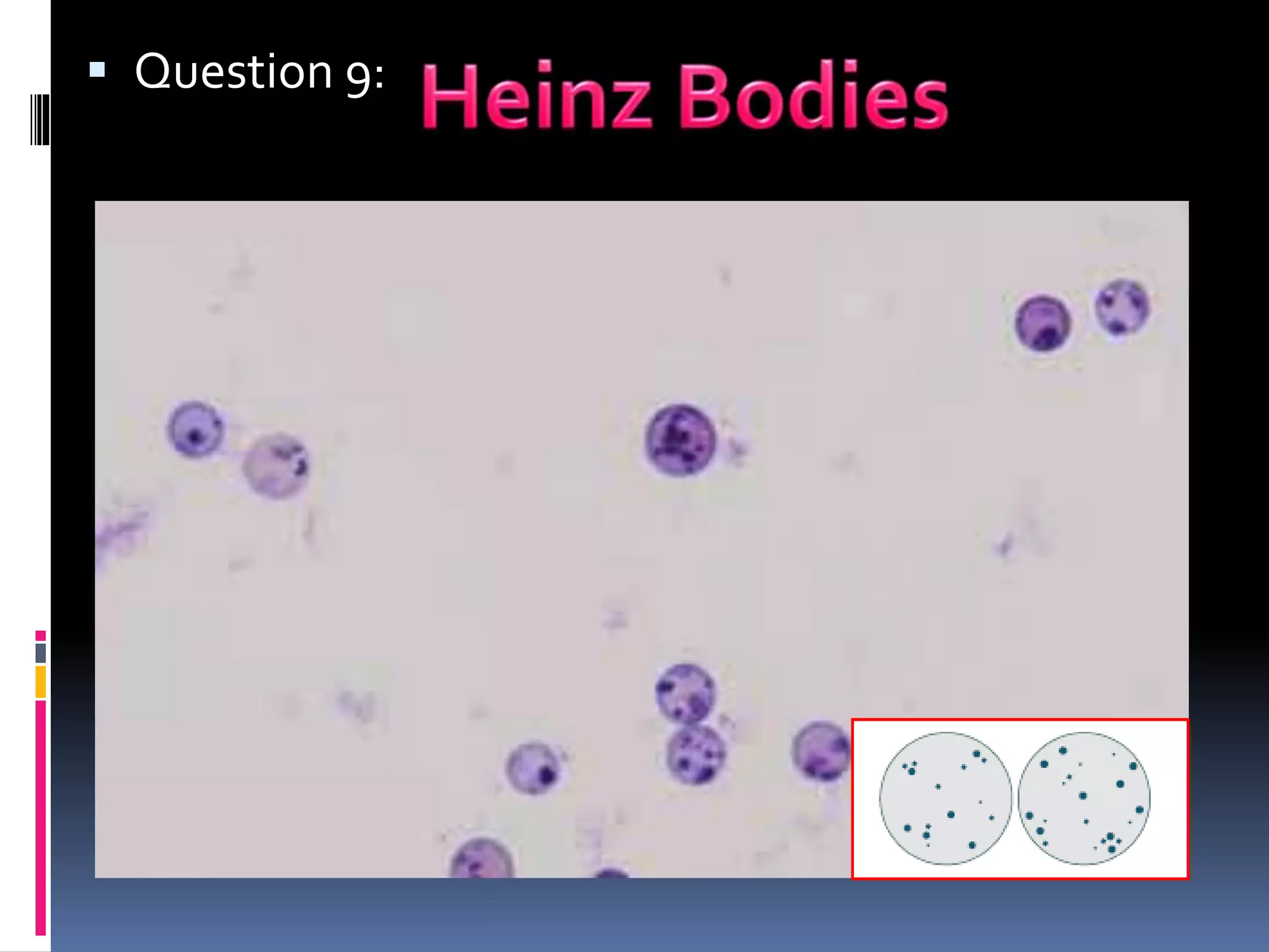 Peripheral smear..RBC disorders.. Dr.Padmesh | PPTX