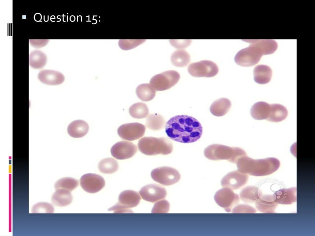 Peripheral smear..RBC disorders.. Dr.Padmesh | PPT