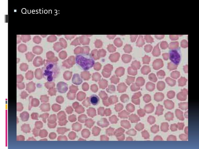 Peripheral smear..RBC disorders.. Dr.Padmesh | PPT