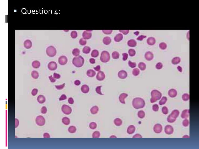 Peripheral smear..RBC disorders.. Dr.Padmesh | PPT | Free Download