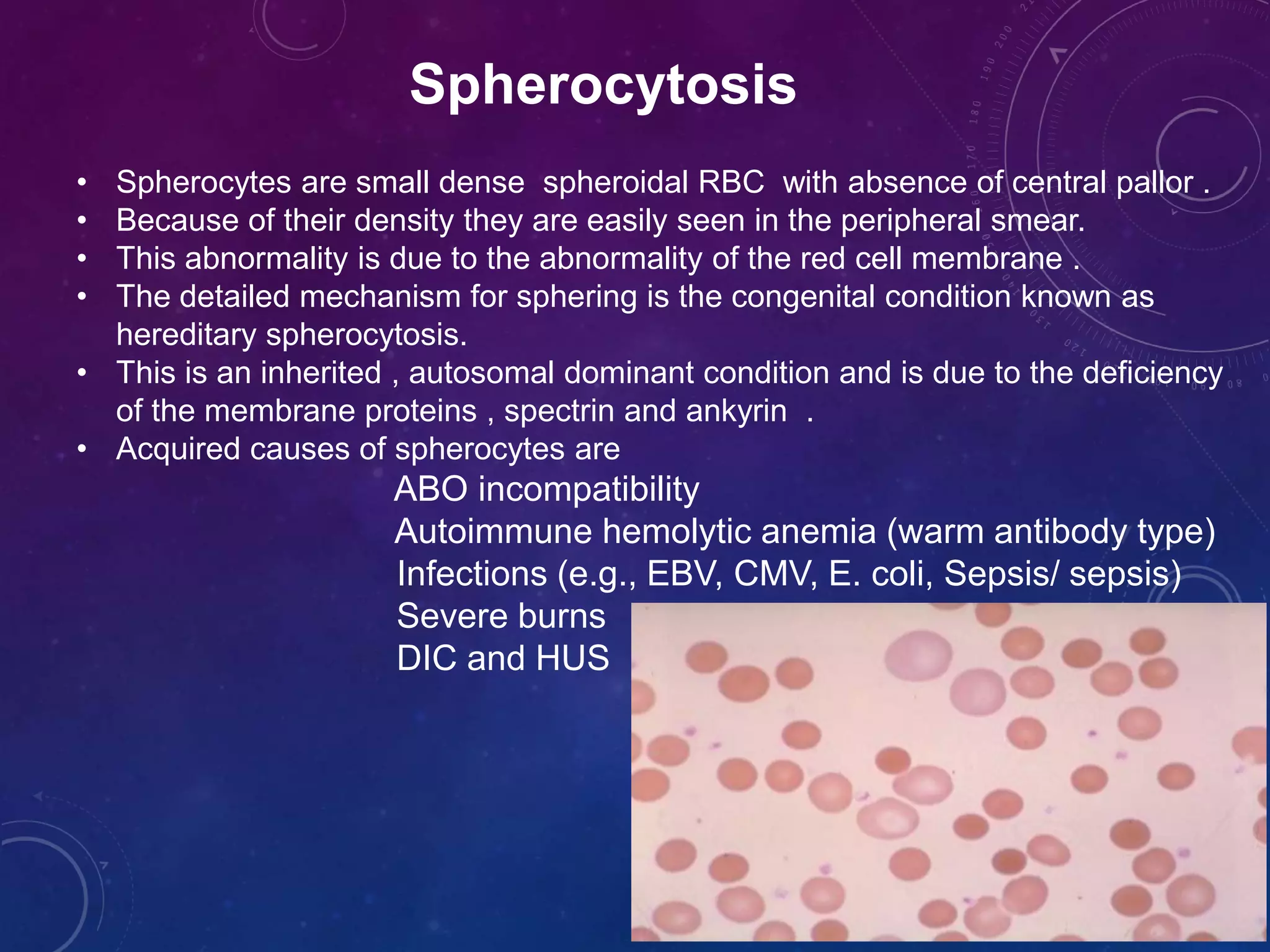 Peripheral smear | PPTX