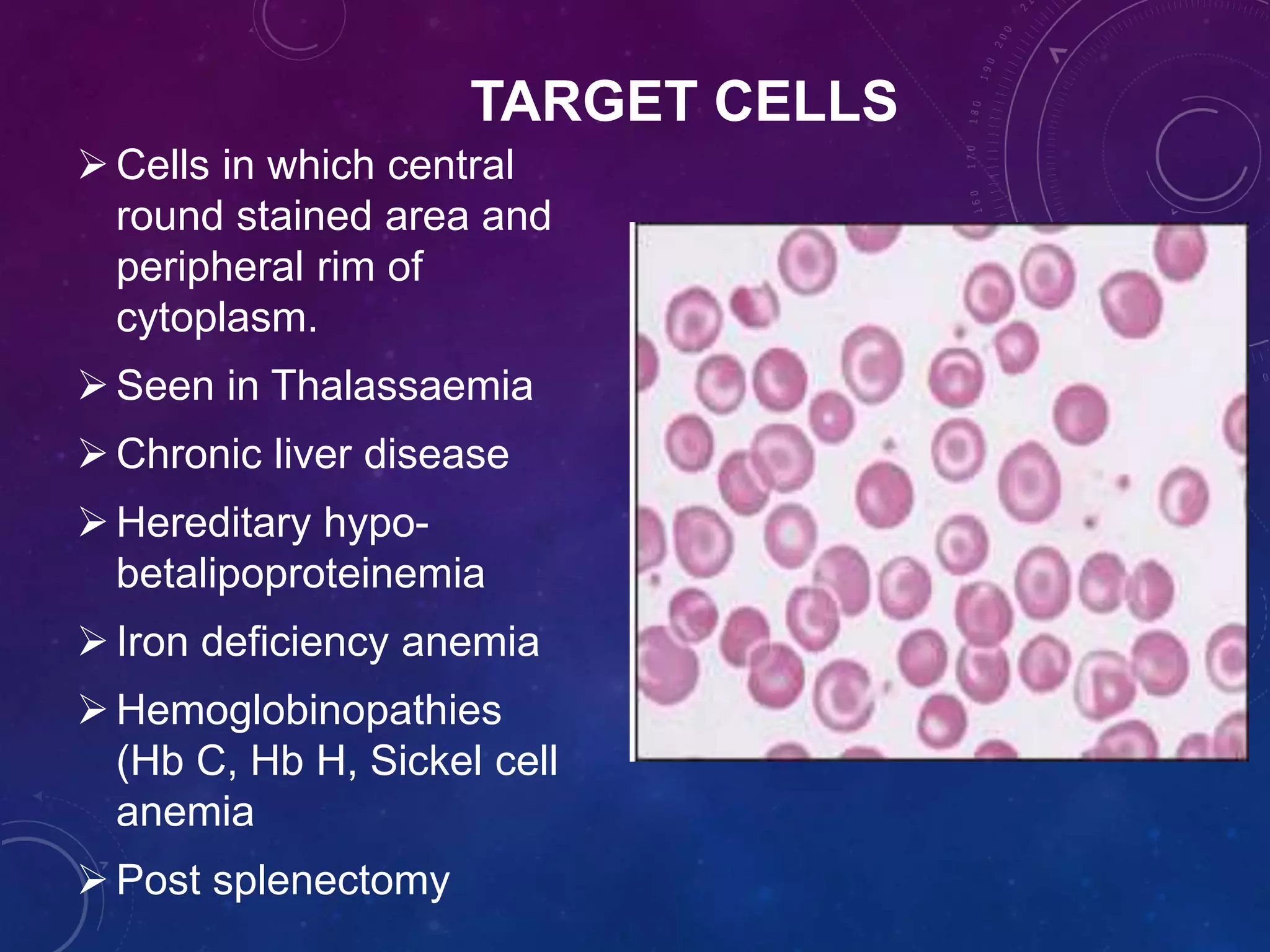 Peripheral smear | PPTX