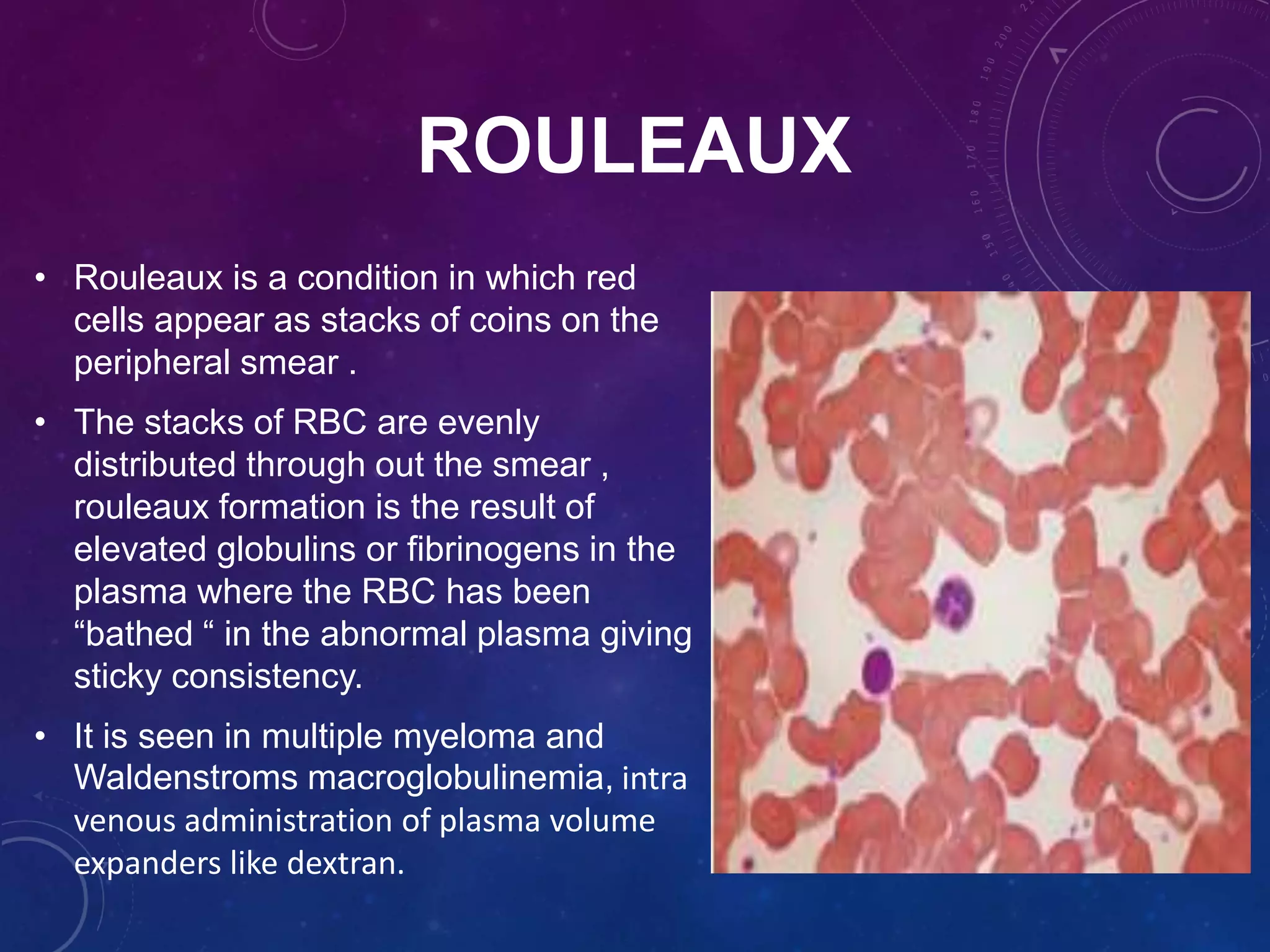 Peripheral smear | PPTX