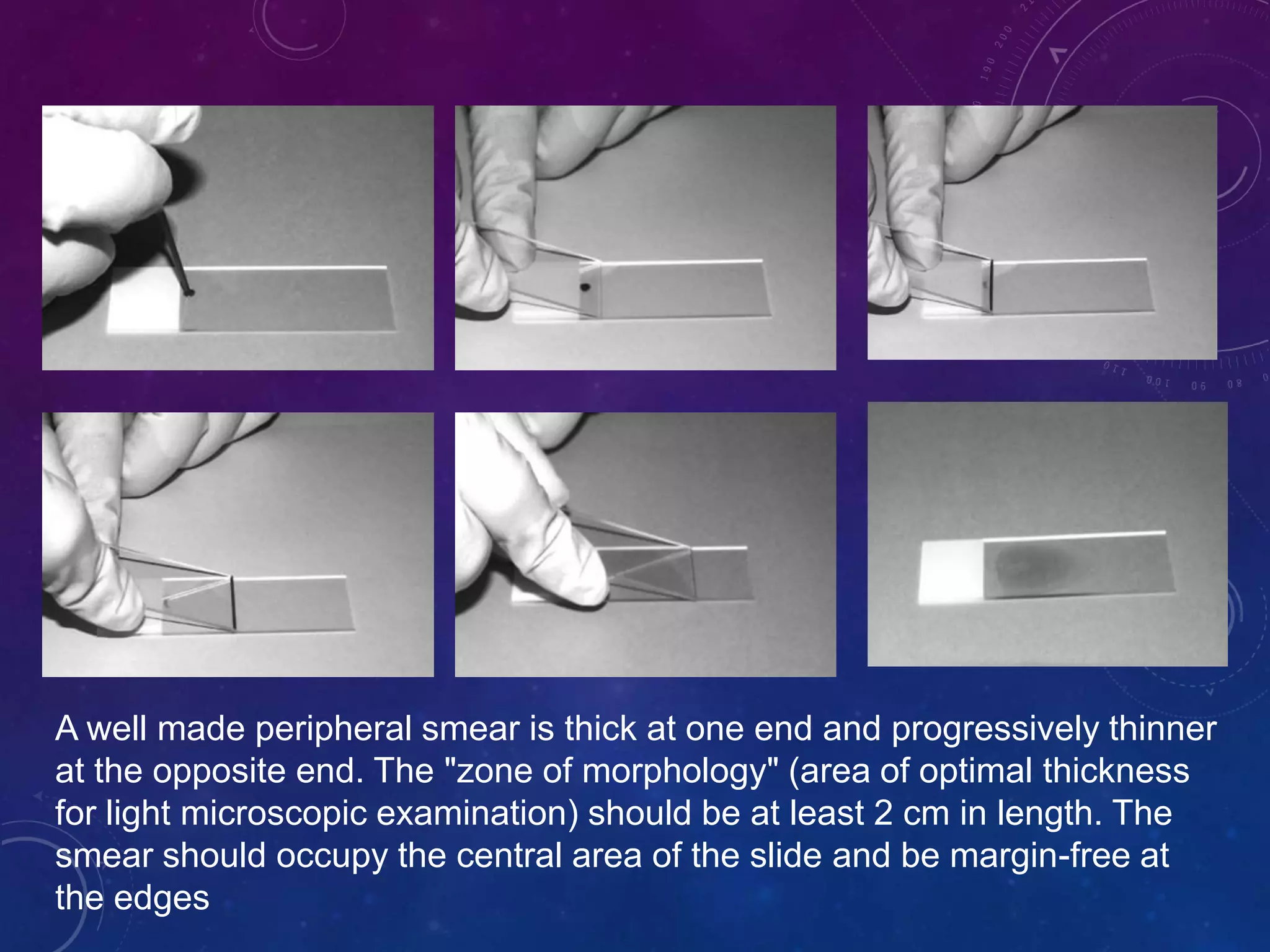 Peripheral smear | PPTX
