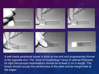 Peripheral smear | PPTX