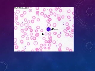 Peripheral smear | PPTX