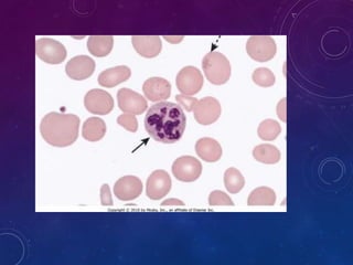 Peripheral smear | PPTX