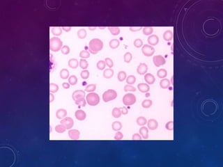 Peripheral smear | PPTX