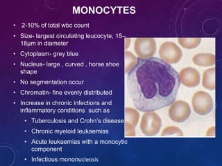 Infectious Mononucleosis Blood Smear