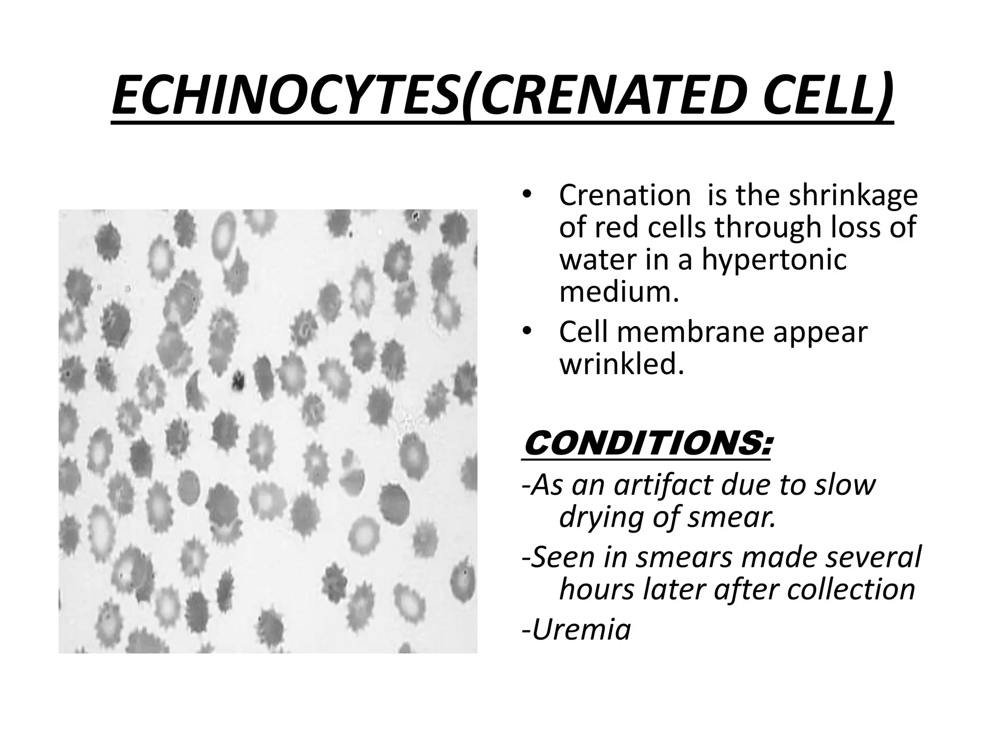 Peripheral smear | PPTX