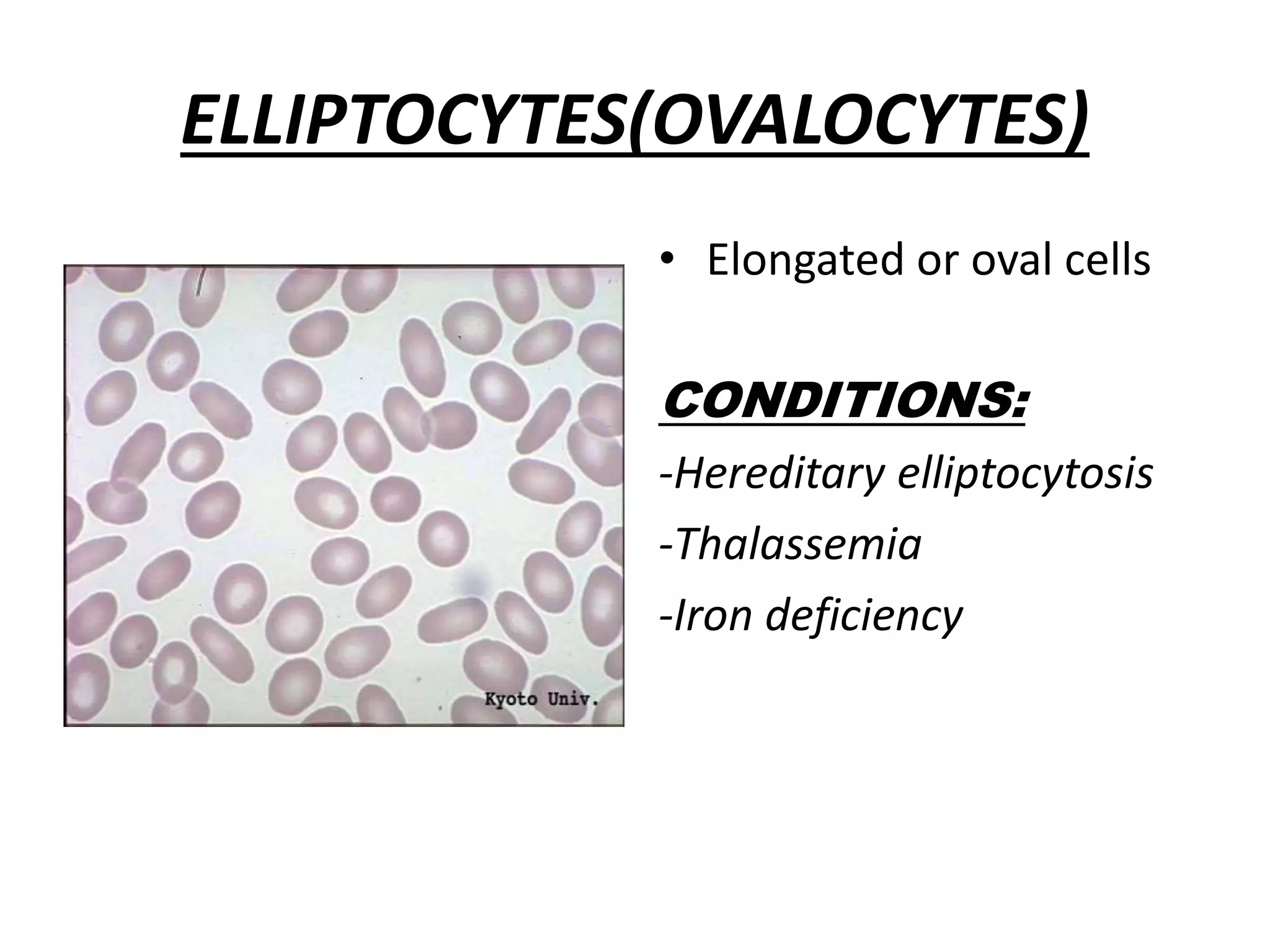Peripheral smear | PPTX