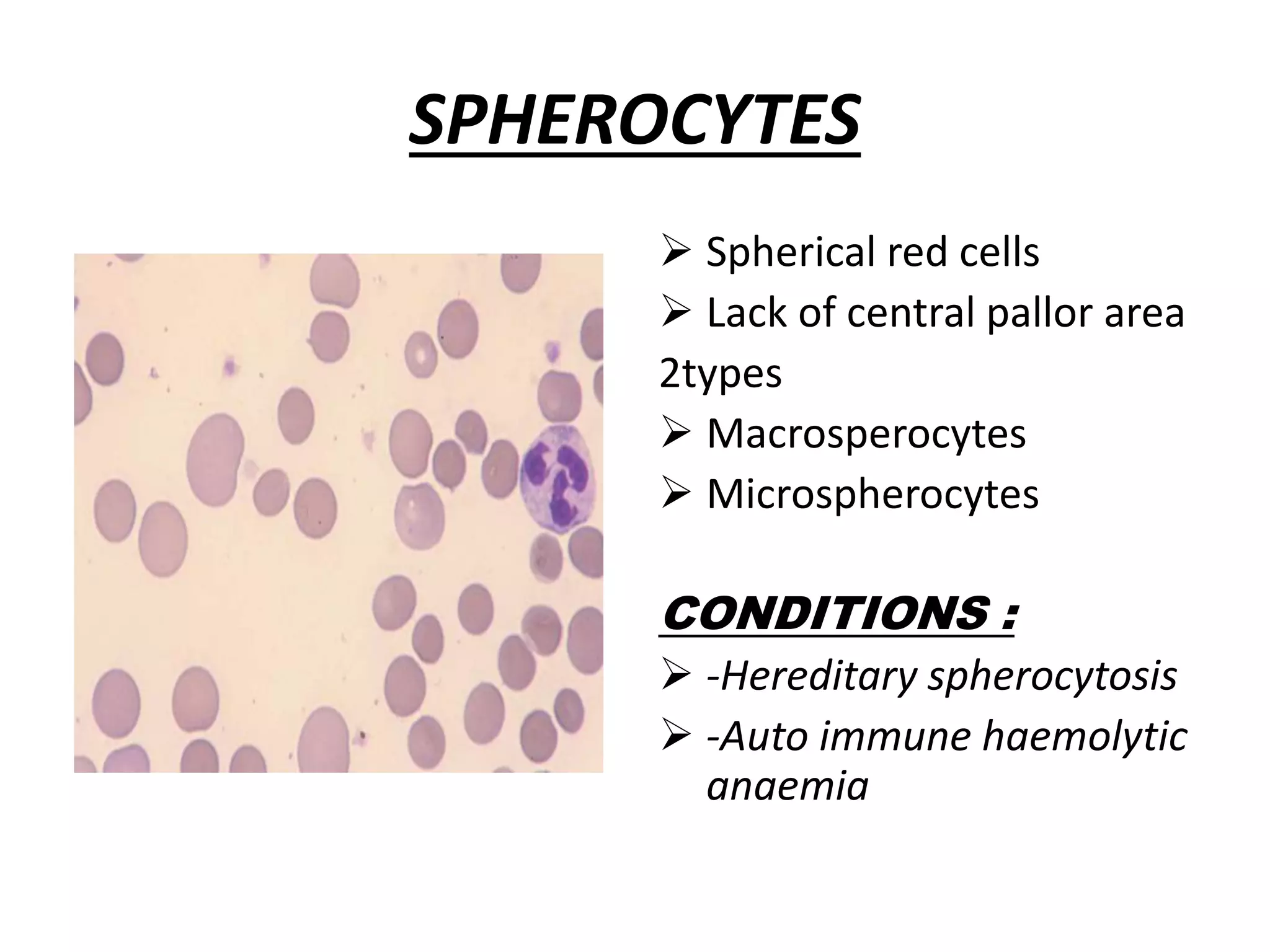Peripheral smear | PPTX