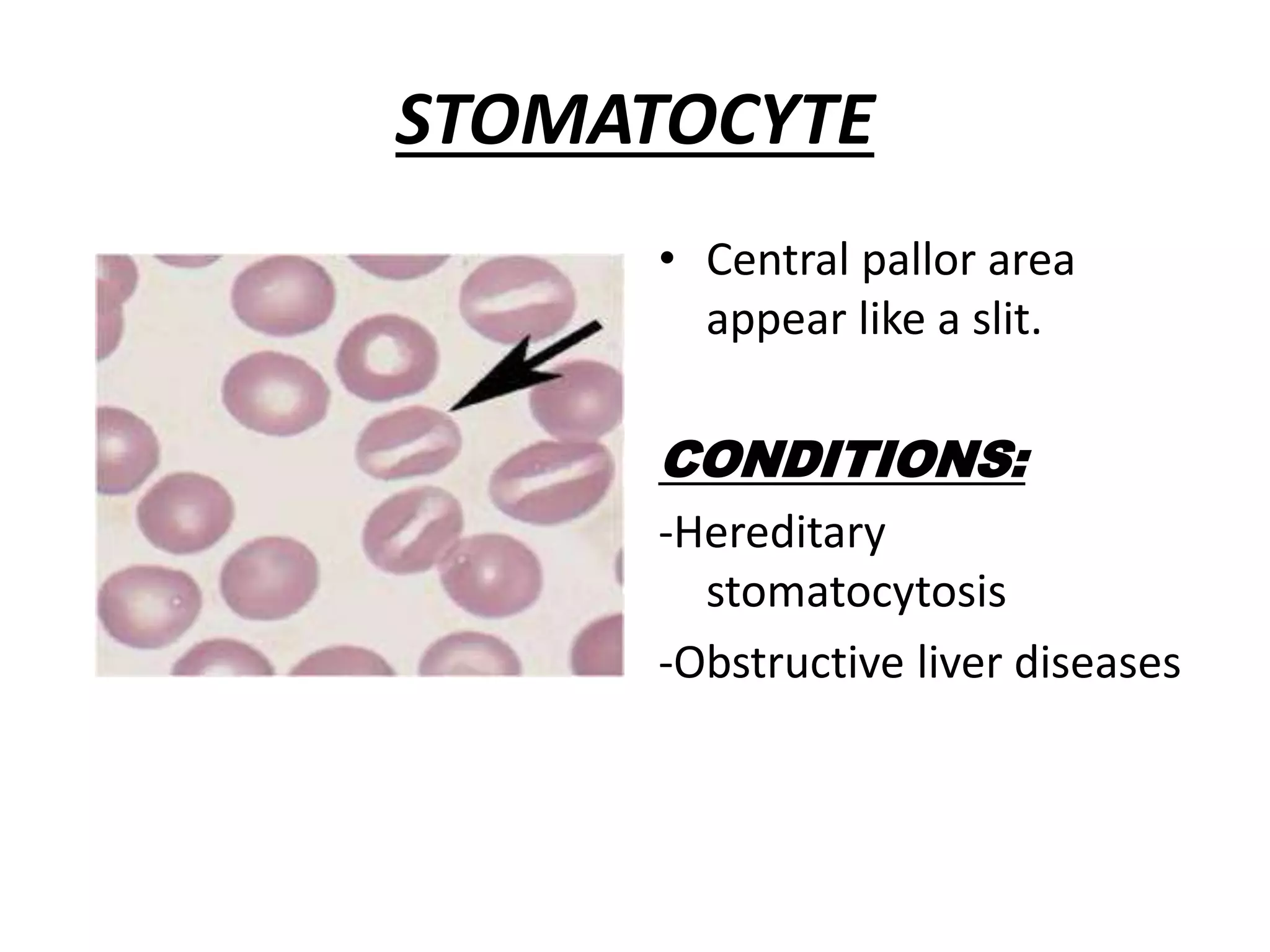 Peripheral smear | PPTX