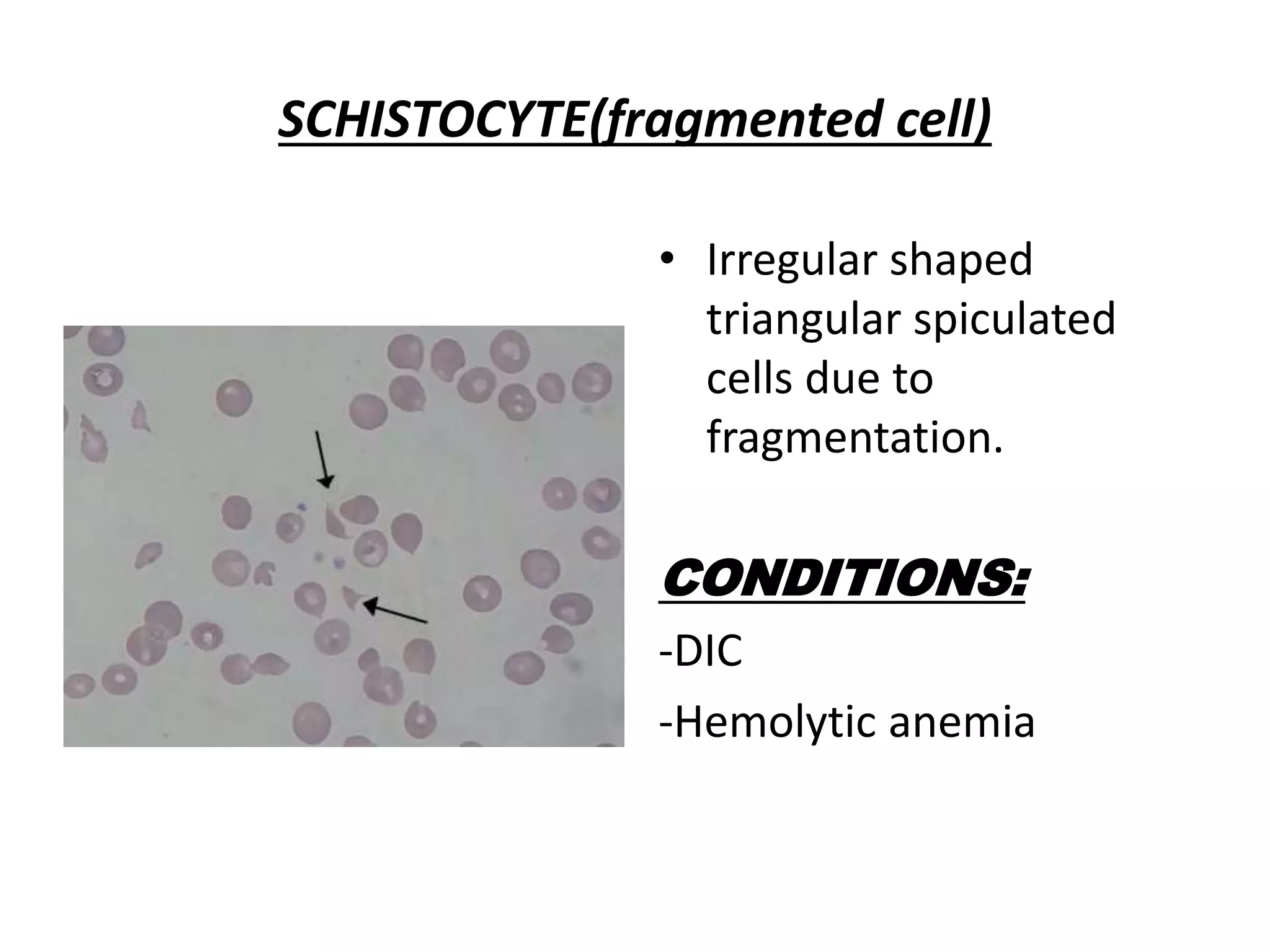Peripheral smear | PPTX