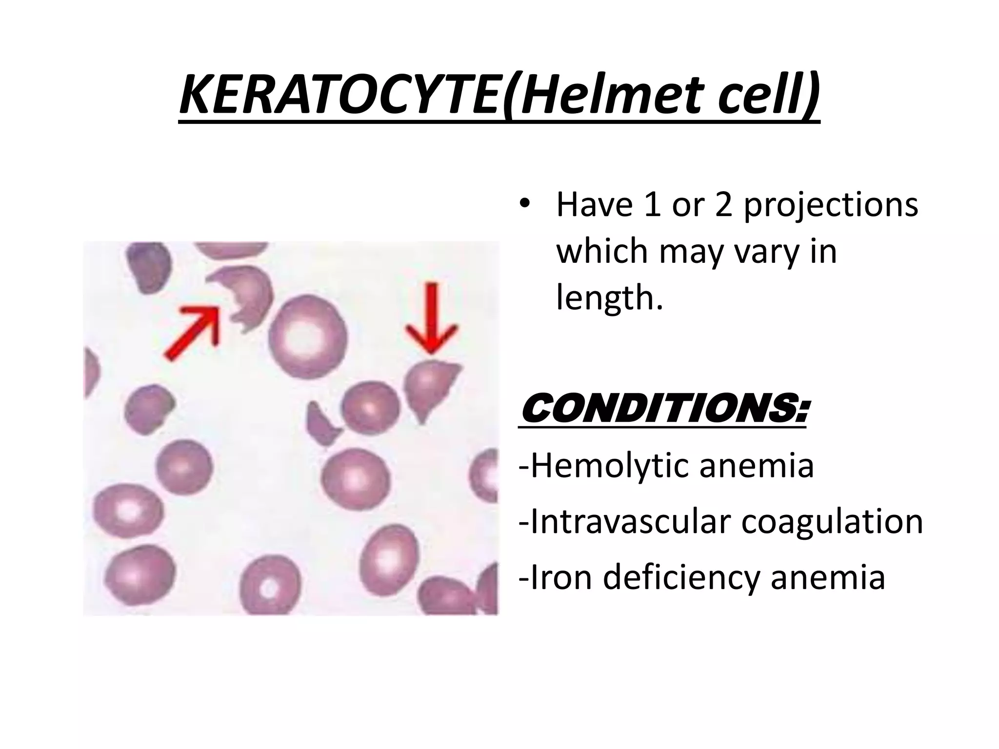 Peripheral smear | PPTX