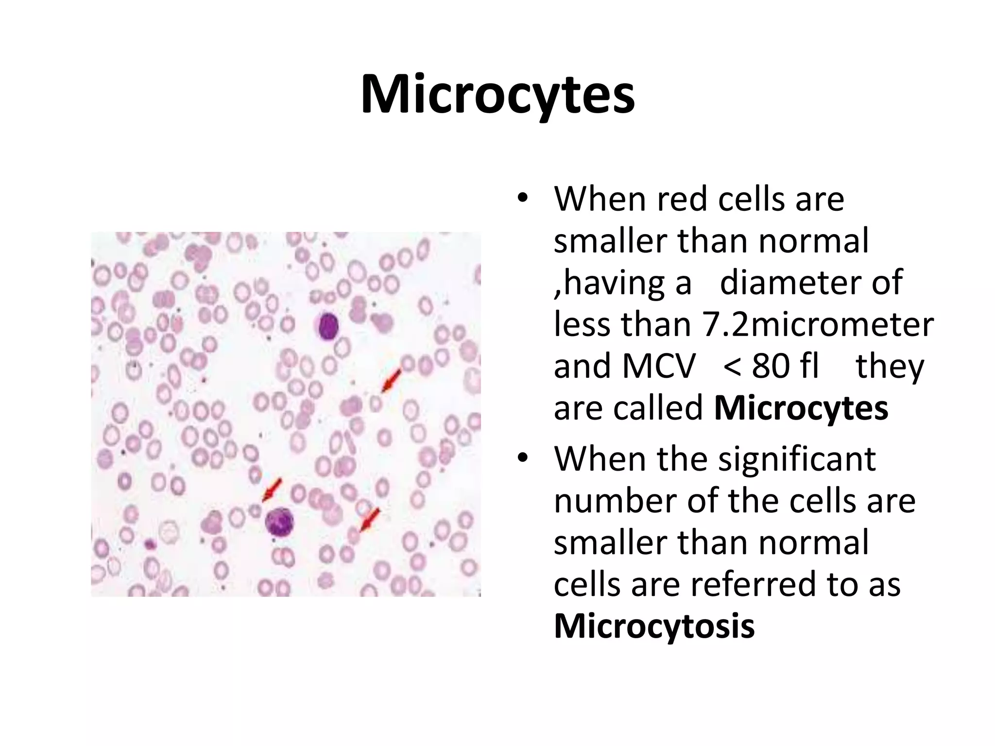 Peripheral smear | PPTX