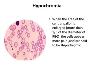 Peripheral smear | PPTX