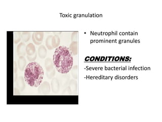Peripheral smear | PPTX