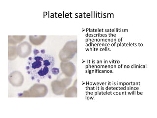 Peripheral smear | PPTX