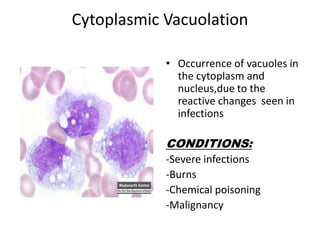 Cytoplasmic Vacuolation