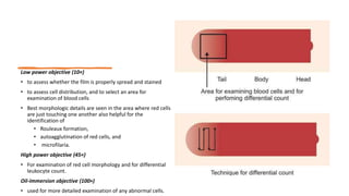 peripheral smear. DMLT.pptx | Blood Disorders | Diseases and Conditions