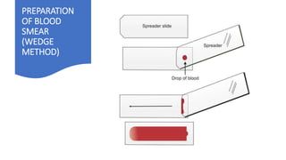 peripheral smear. DMLT.pptx | Blood Disorders | Diseases and Conditions