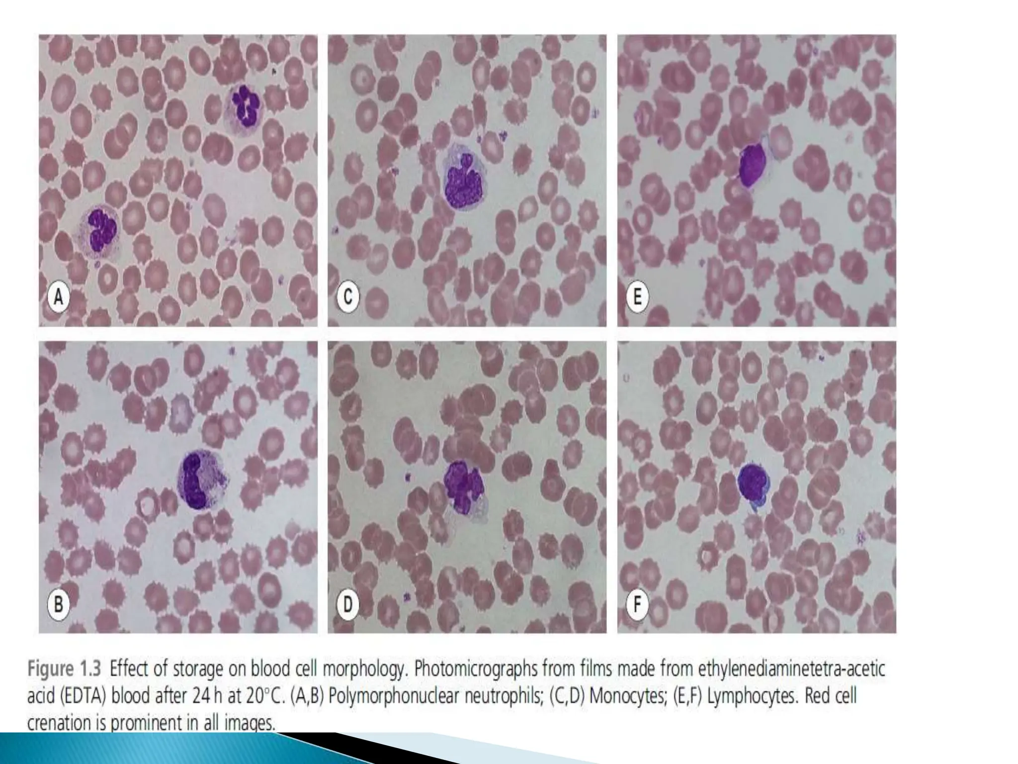Peripheral Smear technique and reporting | PPTX