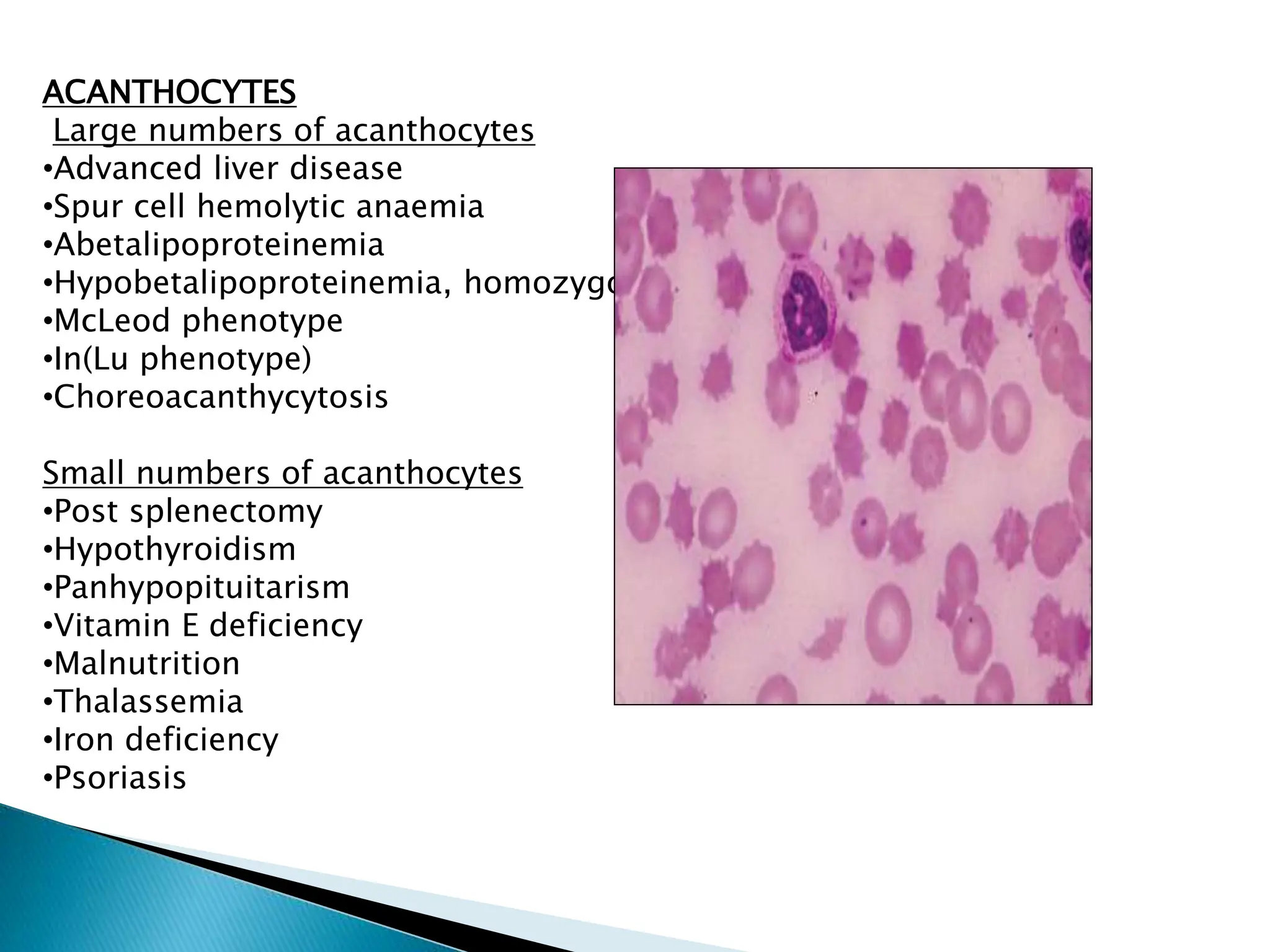 Peripheral Smear technique and reporting | PPTX