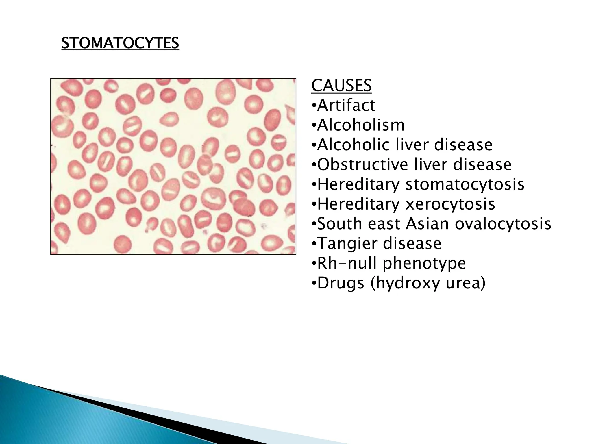 Peripheral Smear technique and reporting | PPTX